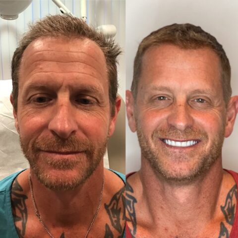 Daxxify - Dr. Jen Armstrong